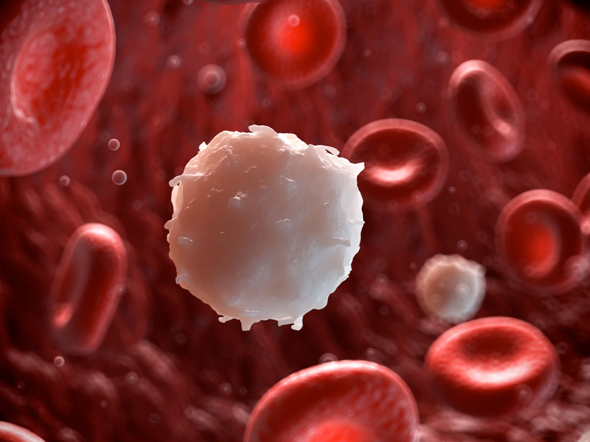 Microcitose Pode Virar Leucemia - RETOEDU